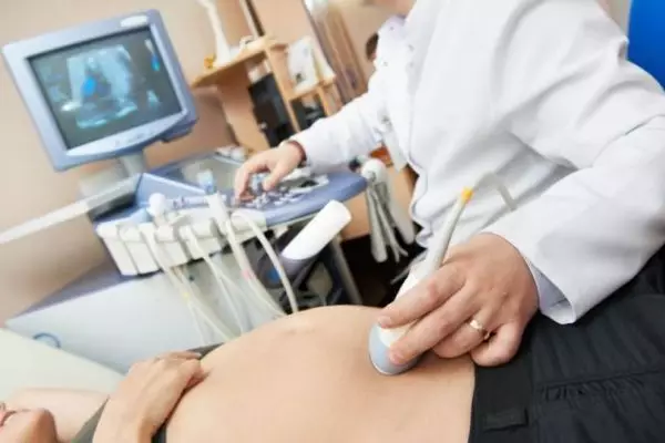 Screening 1 trimester - dekoding resultater