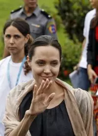 Angelina Jolie me pamje të dhimbshme të hollë