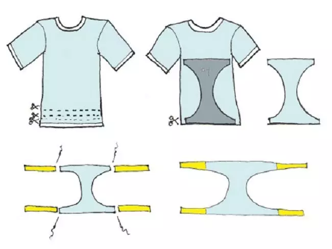 පතුලේ මැහුම්