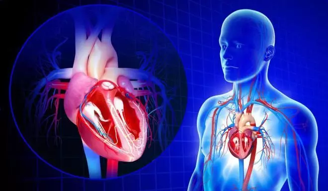 Proceso inflamatorio en el sistema cardiovascular.