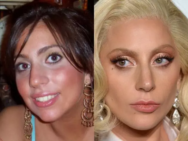 Lady Gaga.