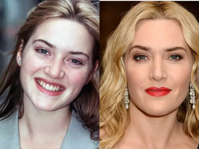 Kate Winslet.