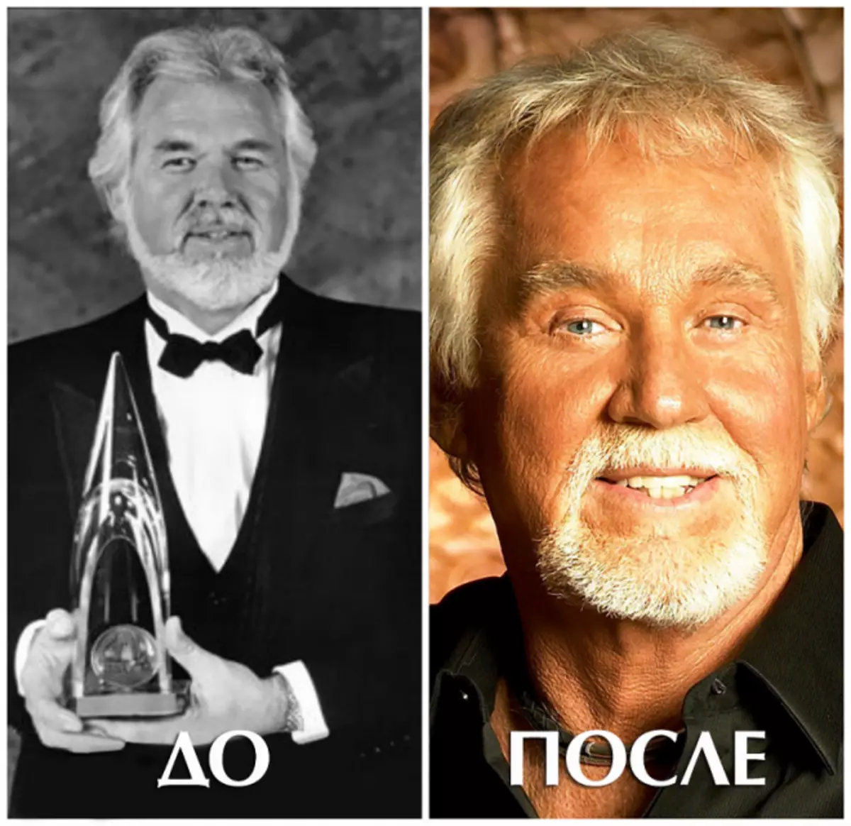 Kenny Rogers.