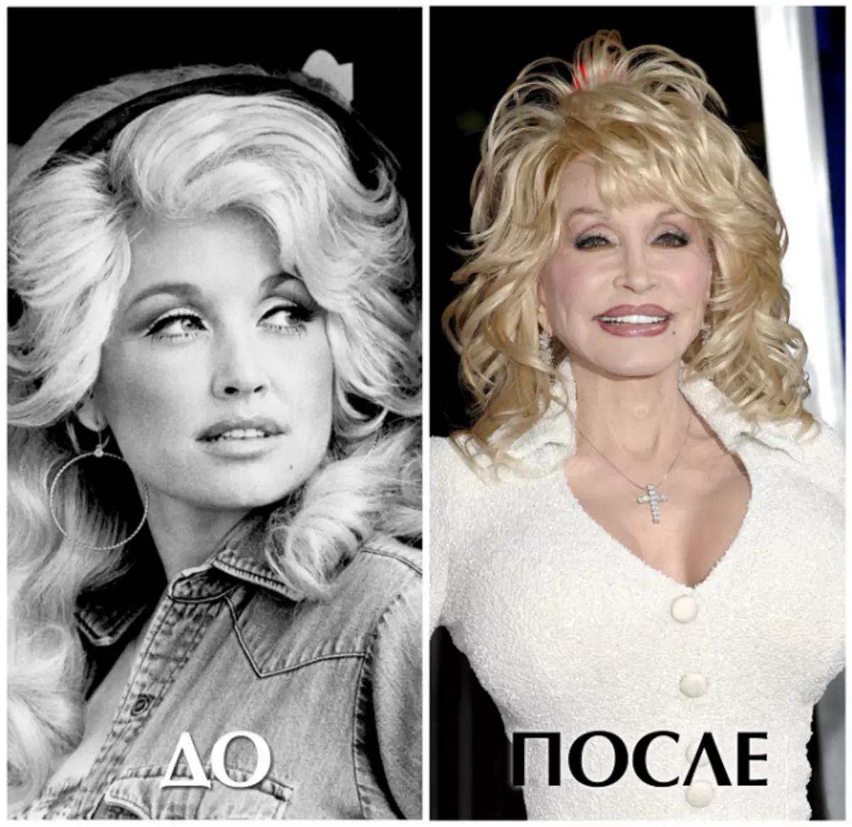 डॉली parton