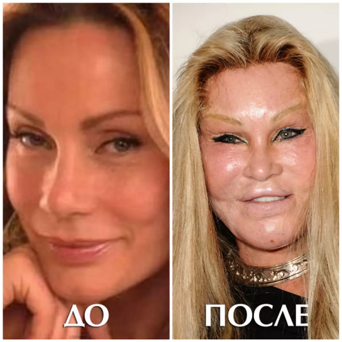 Jocelyn Wildenstein