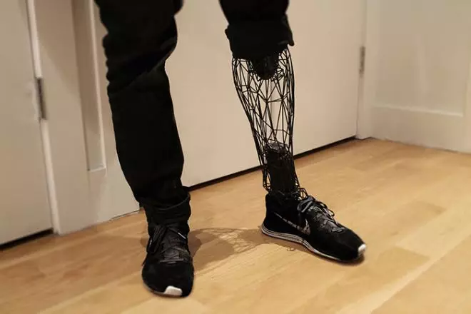 Prosthetic legs.