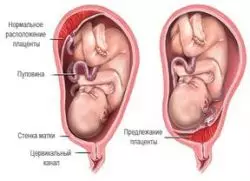 Completa previsione placenta