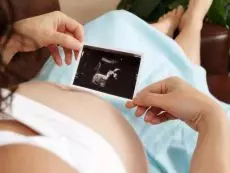 Malovodie pri nosečnicah v poznih datumih