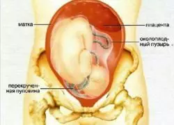 conseqüències de la medul·la curts