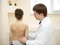 Scoliosis kod djece