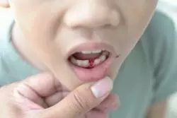 دندان های شیر چه می شود