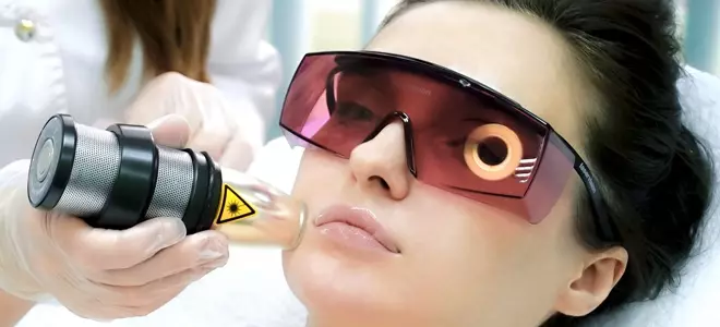 Laserska biorevitalizacija