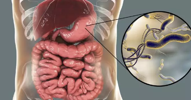 Helicobacter tijaari - sababa iyo daaweynta cudurka caabuqa shinnida