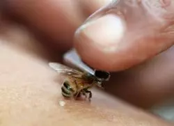 علاج التهاب الجذر من قبل النحل