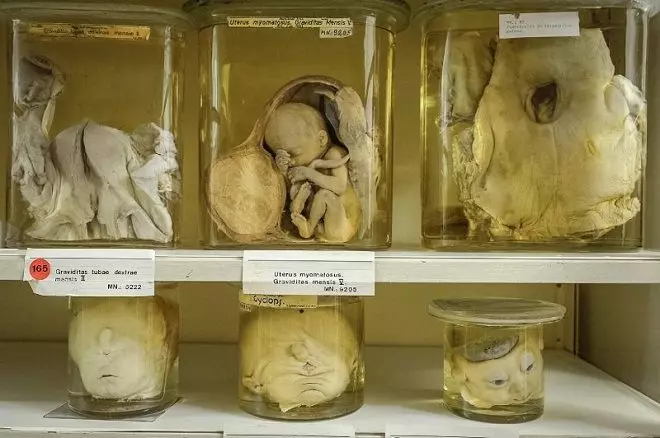 Museum of Pathologatomy (Wien)