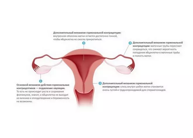 I-Hormonal Totraception-Iziphumo ebezingalindelekanga, izimvo ezisisiseko, indawo oya kuyo kunye neMithetho yokwamkela 4391_3