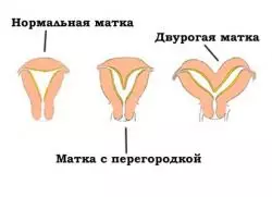 וואָס טוט די קאָונסיאַ יוטעראַס מיינען?