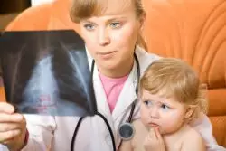 O tratamento da inflamación pulmonar en nenos