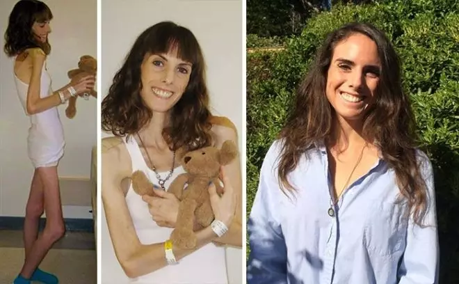 Anorexchicks estaria disposat a parar, però ja no pot