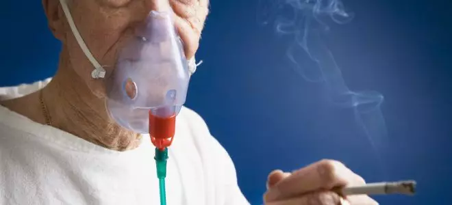 Copd - Yini le, kuphathwa kanjani? Isifo esingama-pulmonary esingamahlalakhona - izimpawu, ukwelashwa, isikhathi sokuphila 56342_2