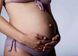 Ako odstrániť Stretch Mark Po pôrode