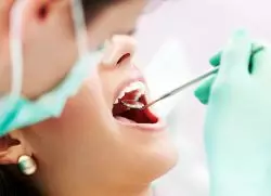 Dental Bridge