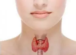 قوم شڪايتن سان thyroid غدود جو علاج