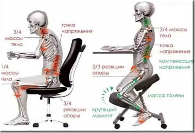 Тізе нәжісі - осындай дизайнды қалай өзгерту және отыру керектігін қалай таңдауға болады? 8857_3