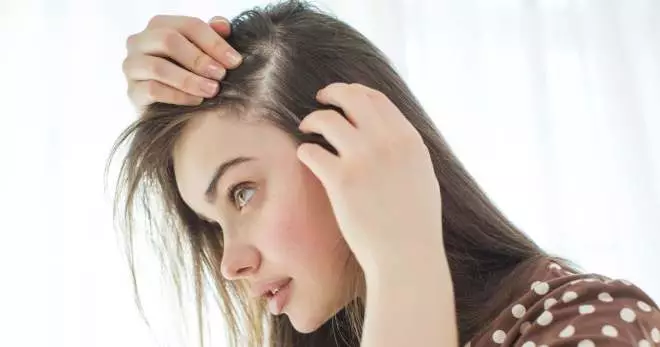 Alopecia - Ilearen galera osoaren, difusio eta fokalaren kausak