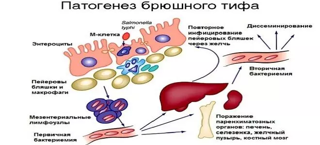 Хэвлийн бичгийн дарцаг, шинж тэмдгүүд, оношлогооны шалтгаан 9900_3